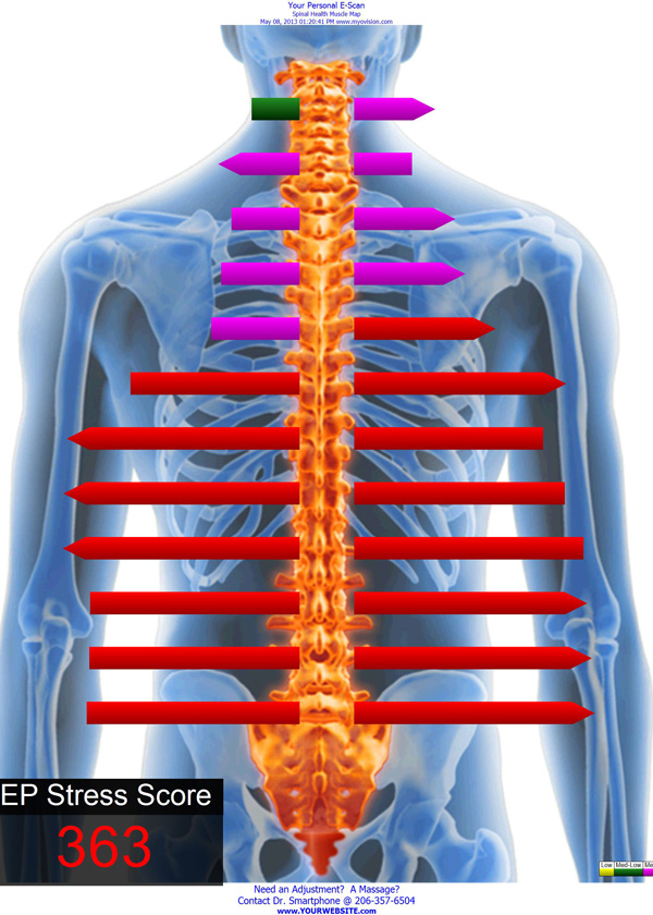 MyoVision Scanning in North Texas - ChiroConcepts - TX